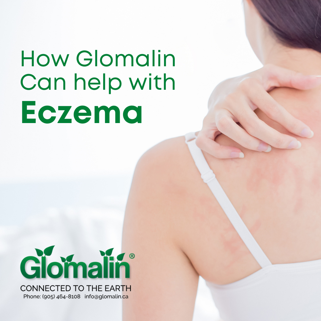 How Glomalin Helps With Eczema – Glomalin Ltd.